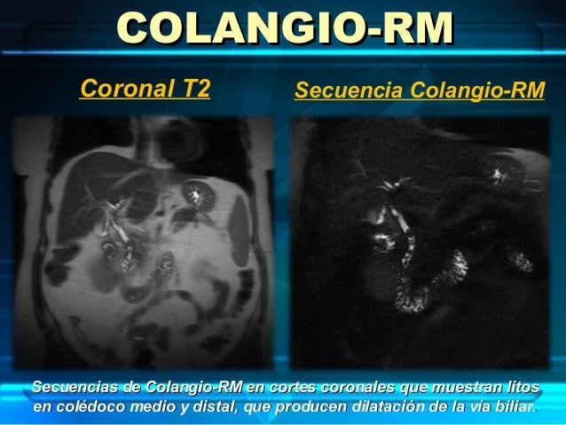 Colangio-RM