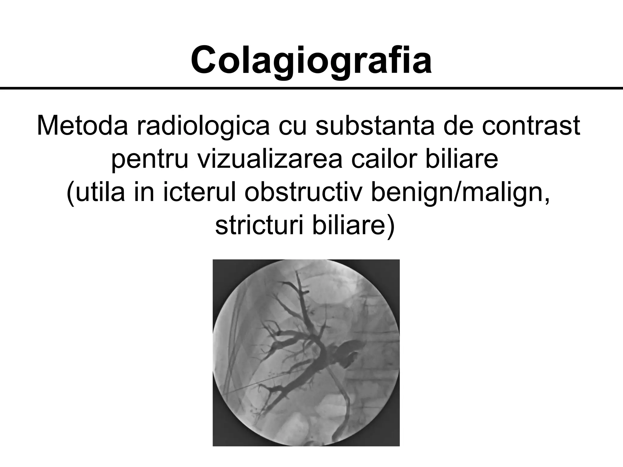 Colangiografie percutana transhepatica si drenaj biliar extern | PPT