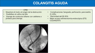 colangitis AGUDA | PPTX