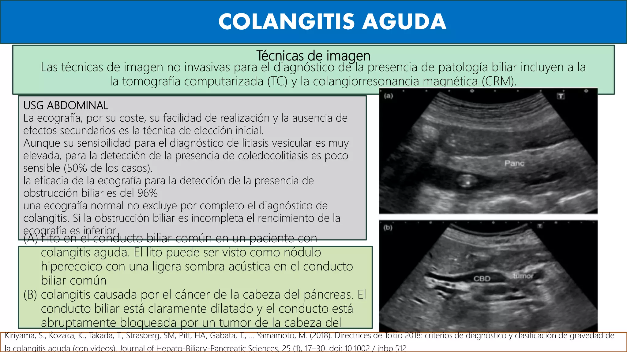 COLANGITIS AGUDA-CIRUGIA/concepto, etiologia, patogenia ...
