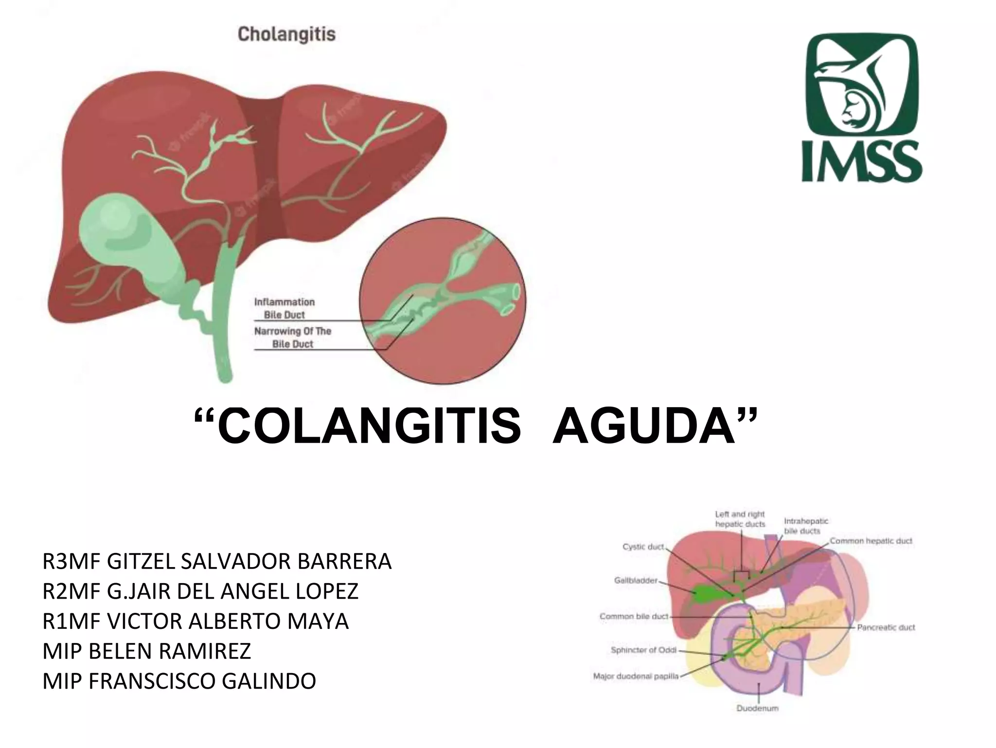 COLANGITIS.pptx