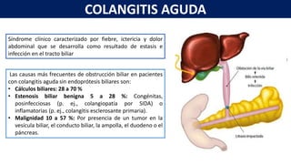 colangitis aguda/patogenia/mnifestaciones clinicas.pptx