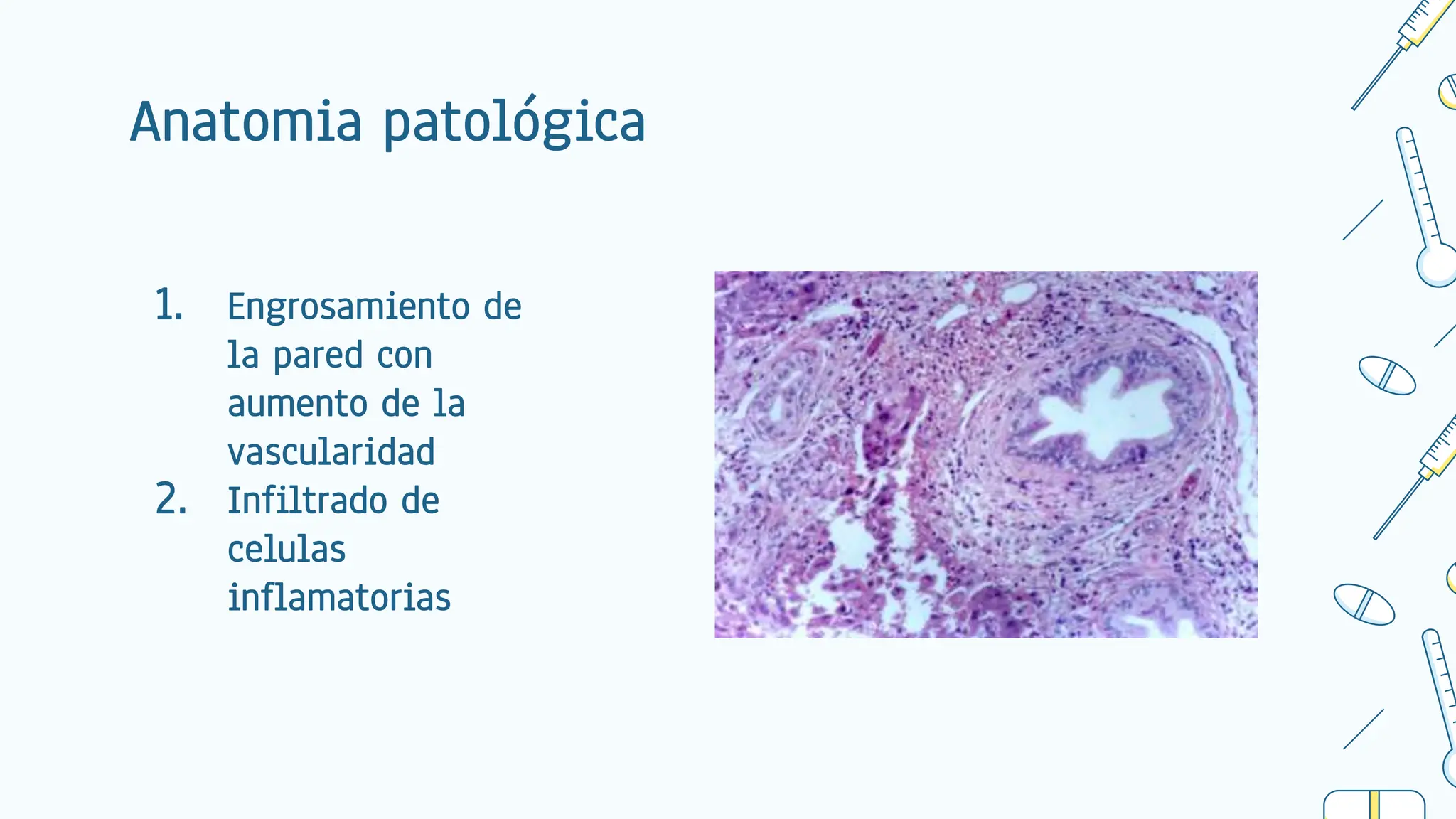 cirugía COLANGITIS - COLEDOCOLITIASIS.pptx