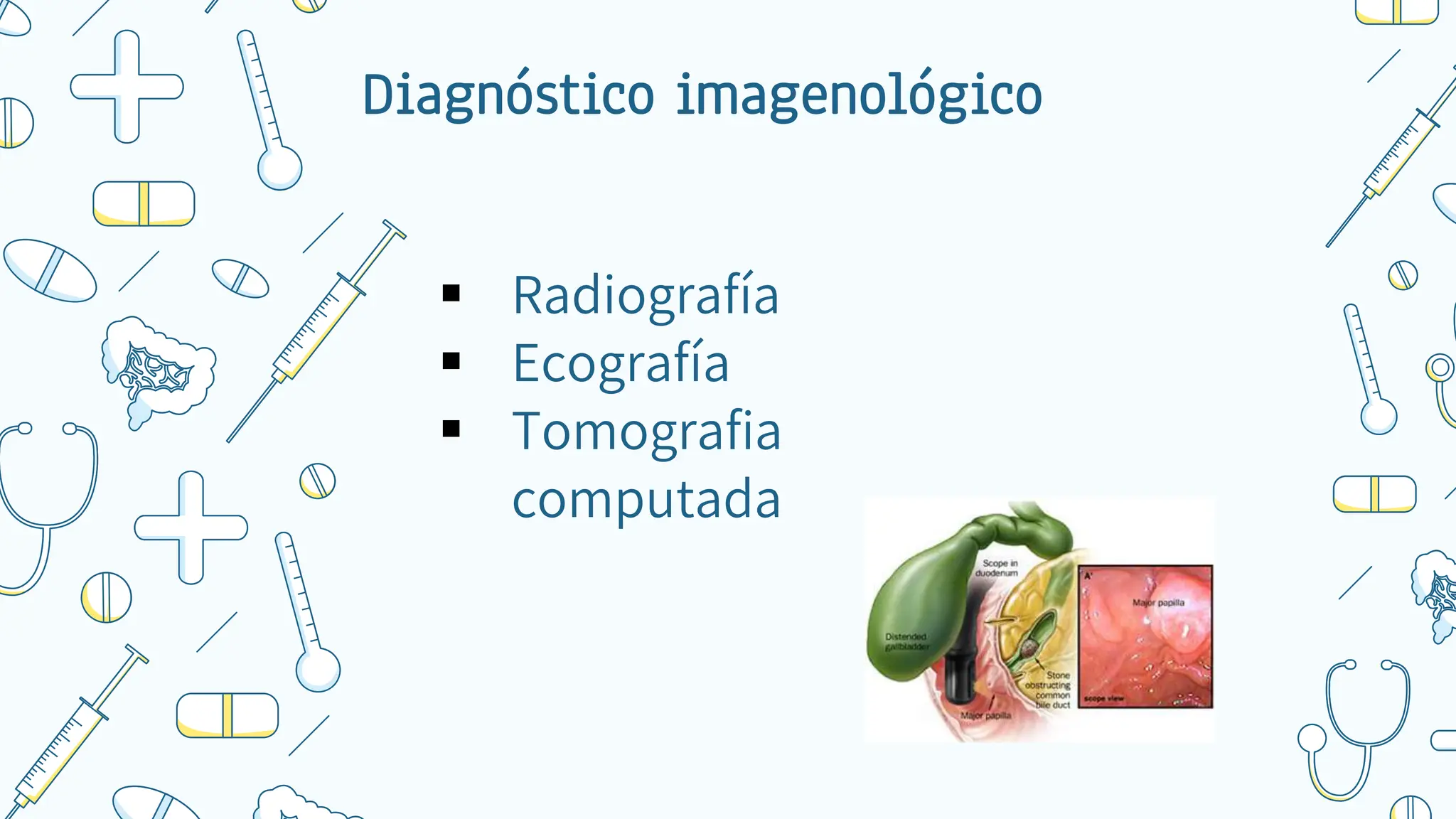 cirugía COLANGITIS - COLEDOCOLITIASIS.pptx