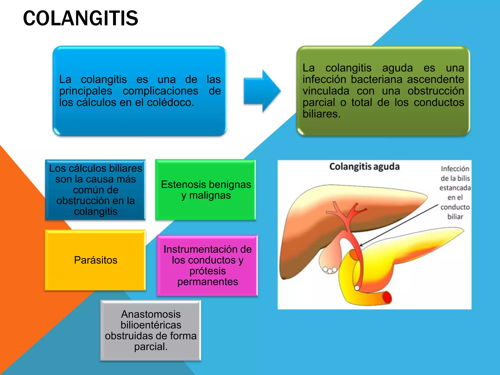 Colangitis aguda | PPT
