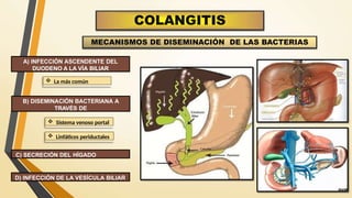 colangitis aguda de patología quirúrgica | PPTX