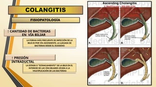 colangitis aguda de patología quirúrgica | PPTX
