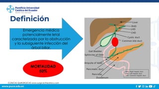 COLANGITIS + COLEDOCOLITIASIS EXPO COMPLETA 2024.pptx