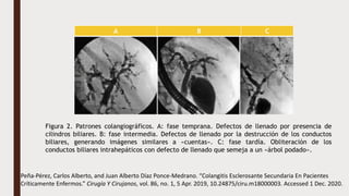 Colangitis esclerosante.pptx