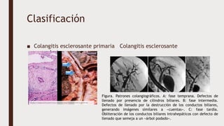 Colangitis esclerosante.pptx