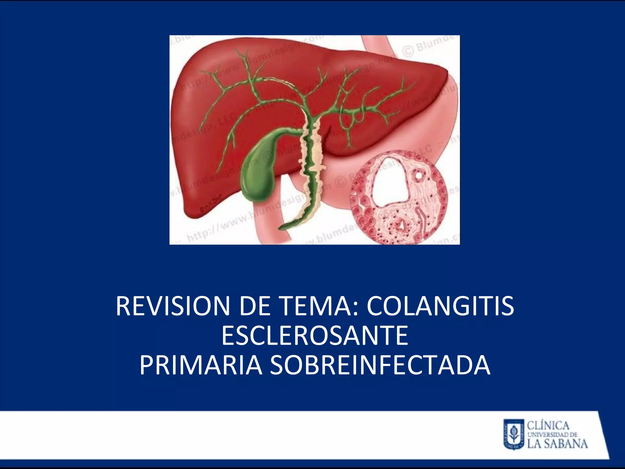 Colangitis esclerosante sobreinfectada caso clinico terapeutico | PPT ...