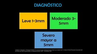 COLAPSO DE MORDIDA Posterior. Seminario. | PPTX