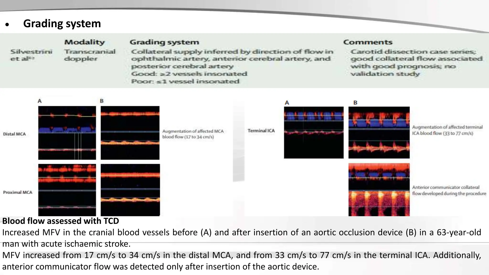 extracranial and intracranial cerebral collateral circulation .pptx