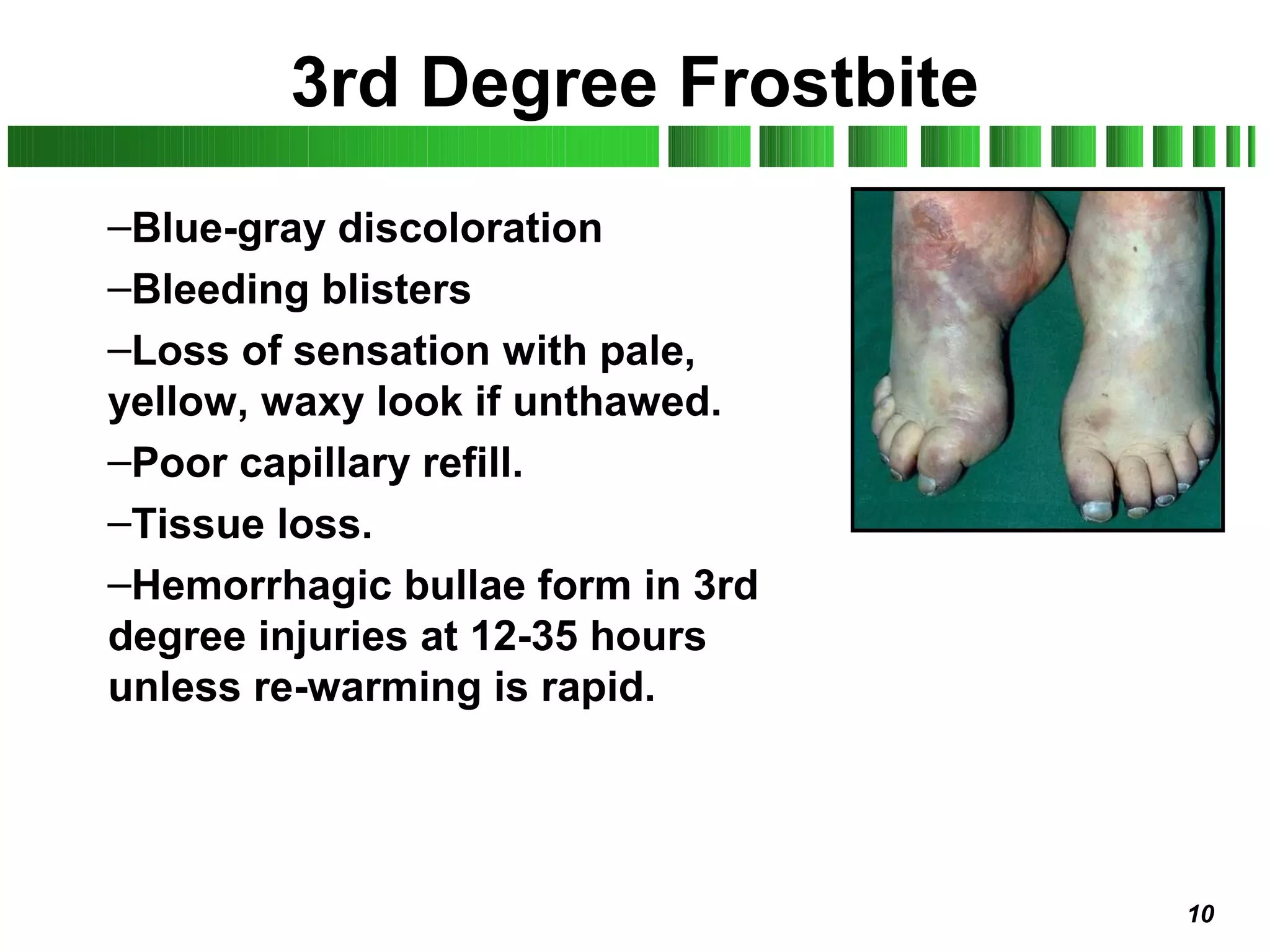 Cold weather-safety extensive power point | PPT