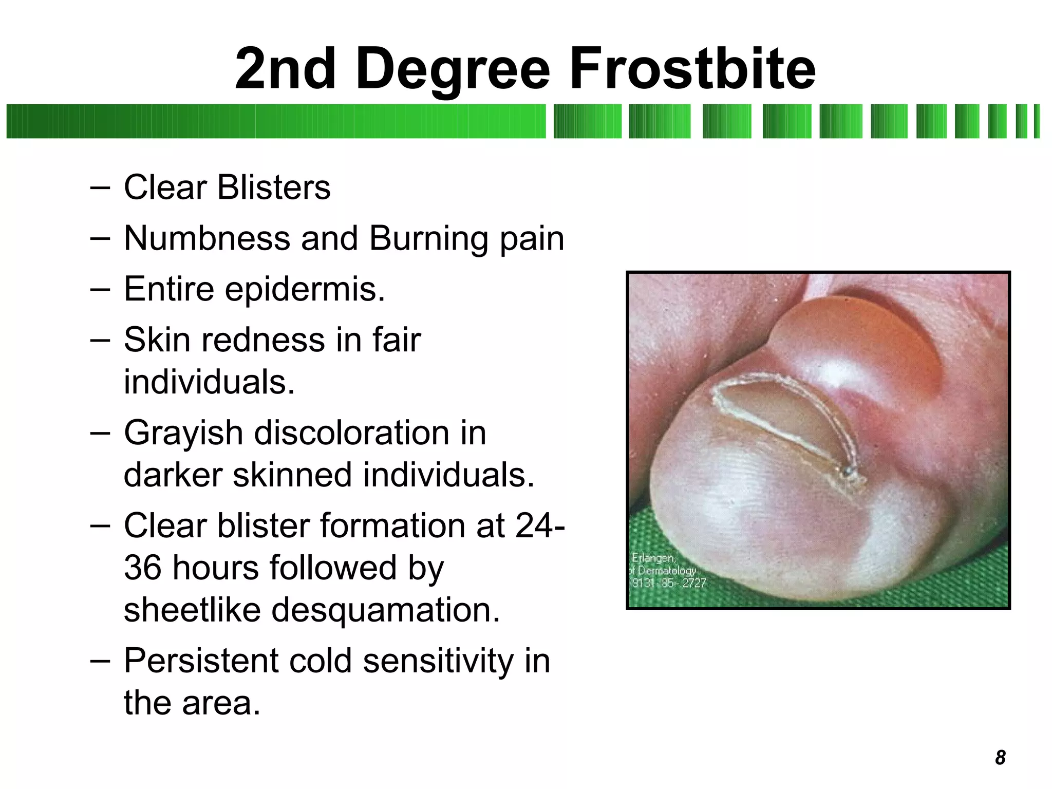 Cold weather-safety extensive power point | PPT