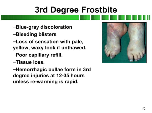 Cold weather-safety extensive power point | PPT