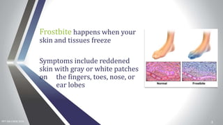 January 2016 - Cold weather work | PPSX