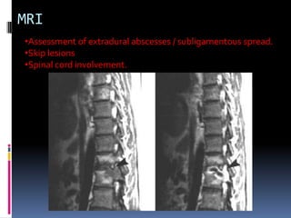 Cold abscess | PPTX