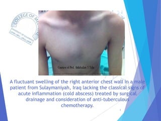 Cold Abscess of the Chest Wall.pdf