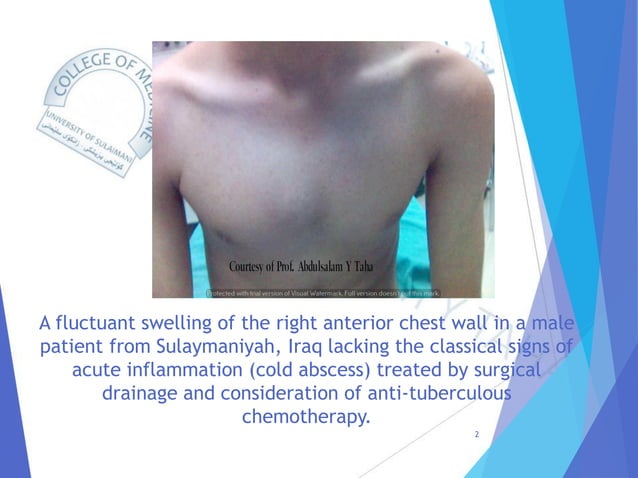 Cold Abscess of the Chest Wall.pdf