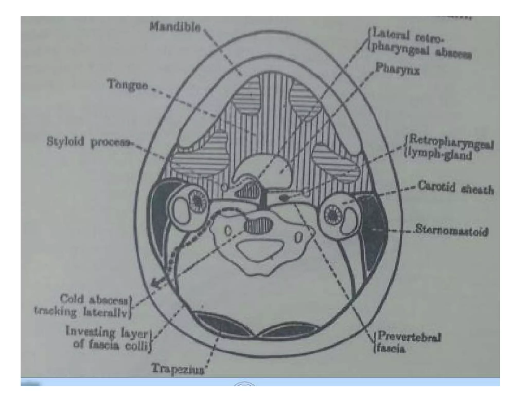 Cold abscess sites | PPTX
