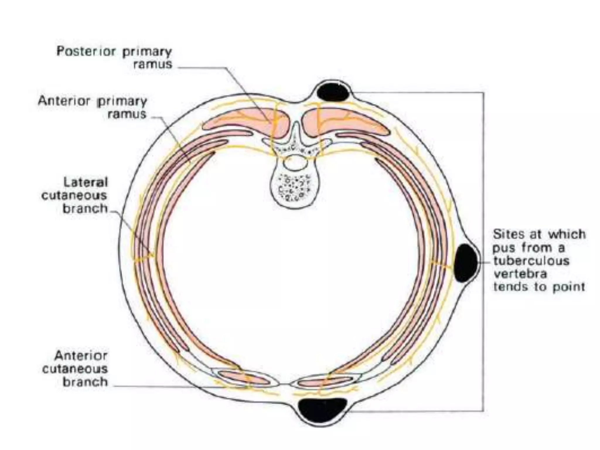 Cold abscess sites | PPTX