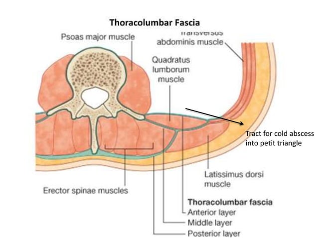 Cold abscess sites | PPTX