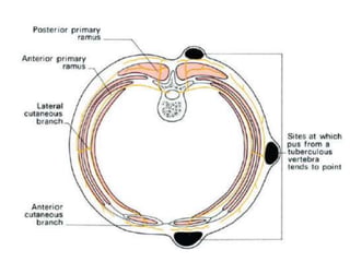 Cold abscess sites | PPTX
