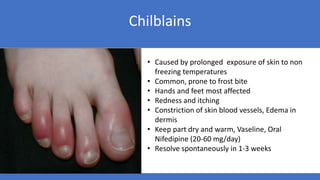Cold and Heat Injuries-AUK.pptx heat and | PPTX