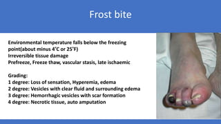 Cold and Heat Injuries-AUK.pptx heat and | PPTX