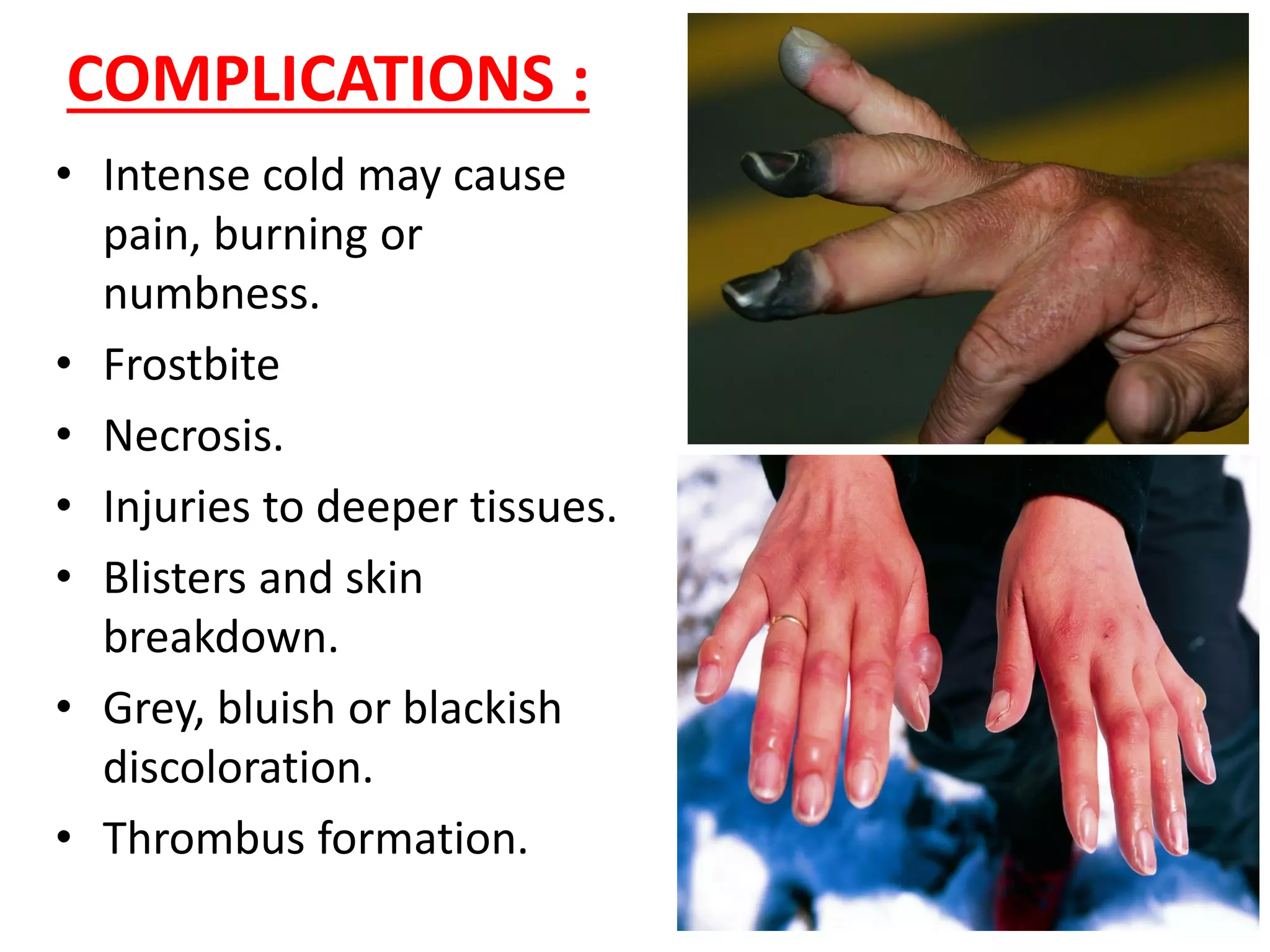 Cold application converted | PDF