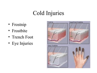 Cold Injuries - Donald Pelto, DPM | PPT