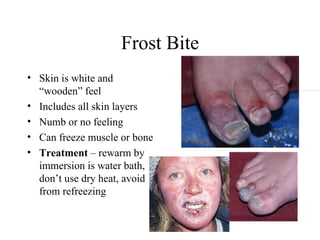 Cold Injuries - Donald Pelto, DPM | PPT
