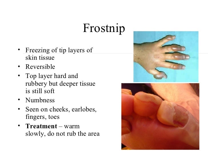 Cold Injuries - Donald Pelto, DPM