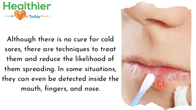 Cold Sores - Healthier Me Today | PDF