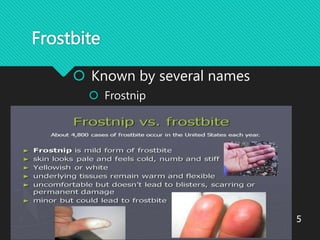 Cold Weather Emergencies.ppt for the patient in distress in cold ...