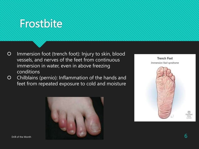 Cold Weather Emergencies.ppt for the patient in distress in cold ...