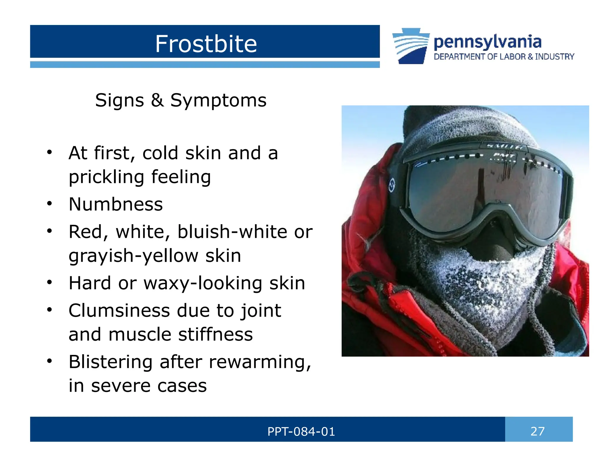 Cold Weather Injuries for winter 2021-01-20.pptx