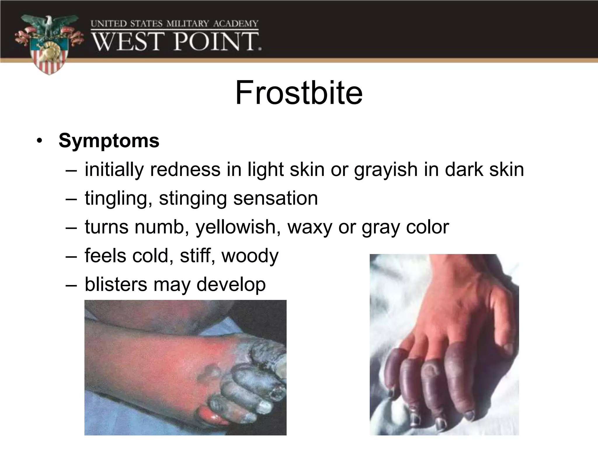 Cold weather injury training, U.S. Army Garrison West Point | PPTX