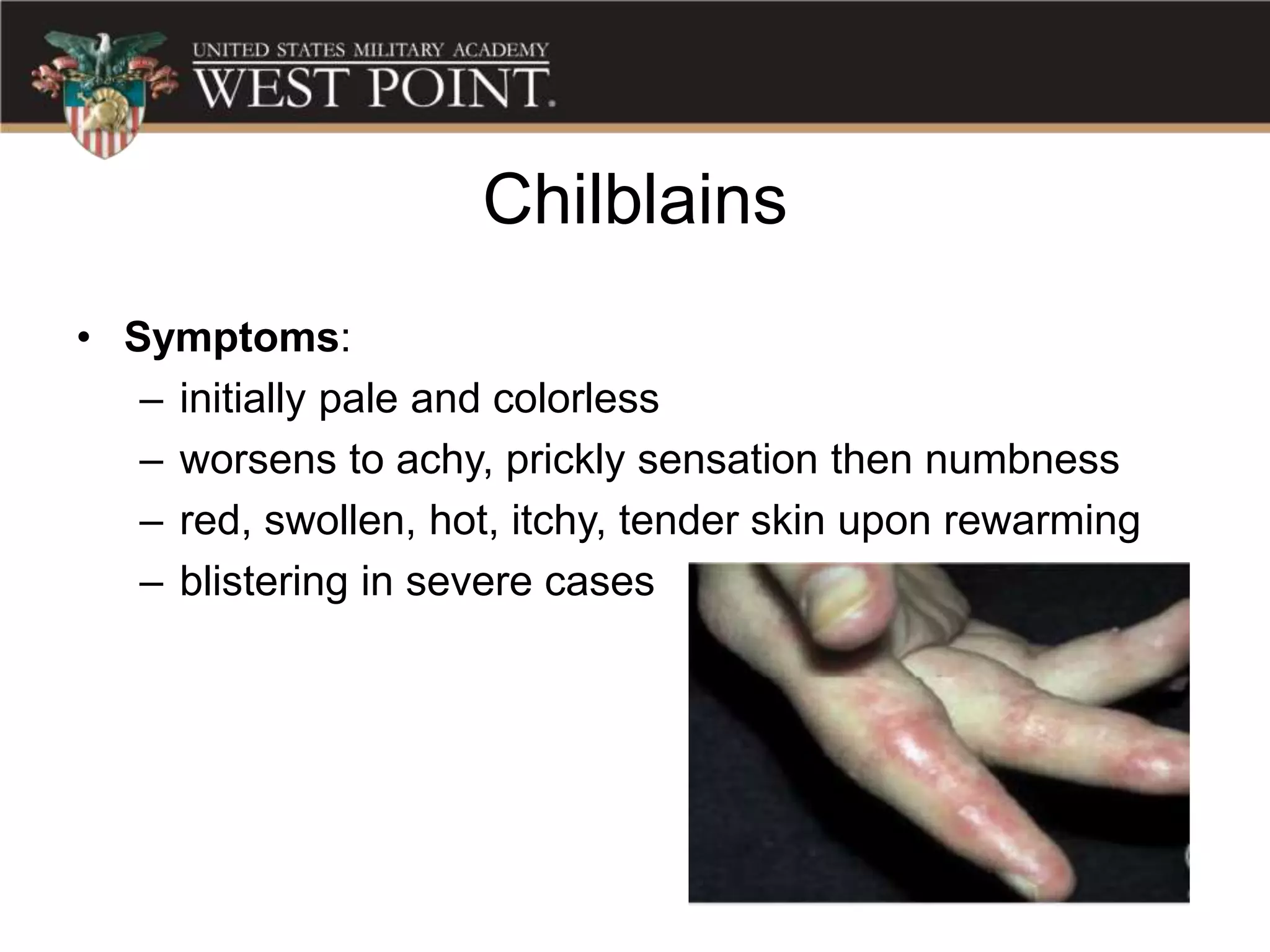 Cold weather injury training, U.S. Army Garrison West Point | PPTX