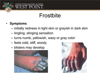 Cold weather injury training, U.S. Army Garrison West Point | PPTX