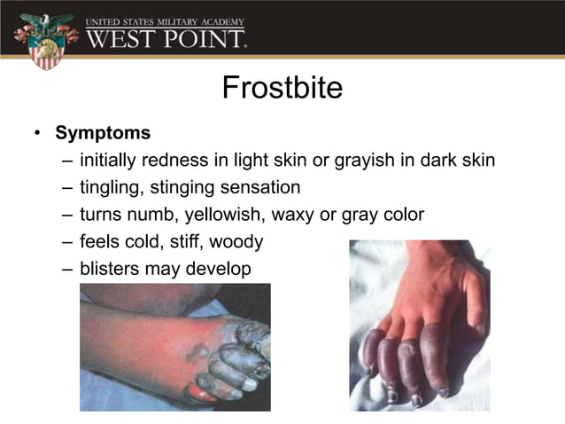 Cold weather injury training, U.S. Army Garrison West Point | PPTX