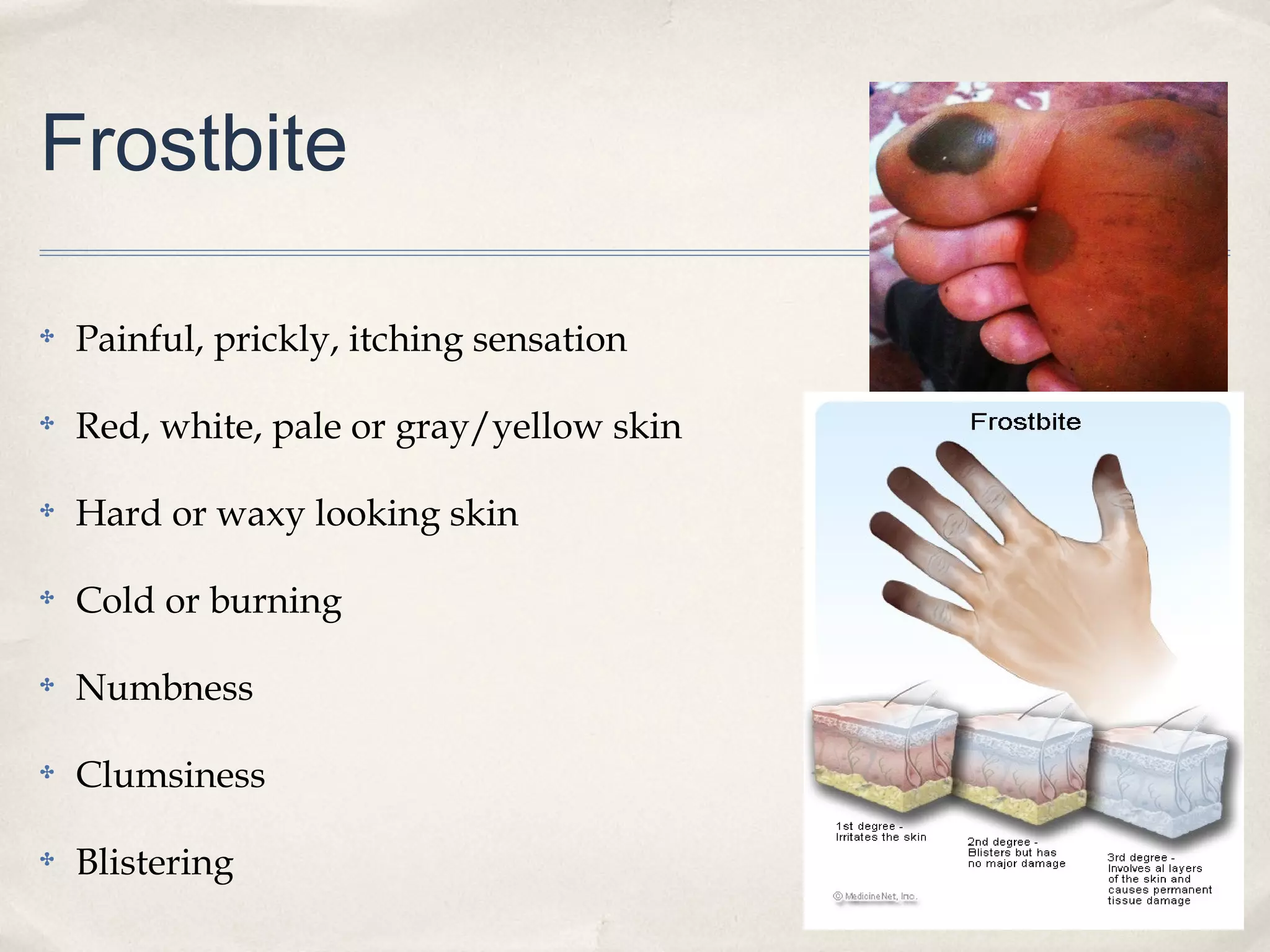 Cold Weather Injuries (Military) | PPT