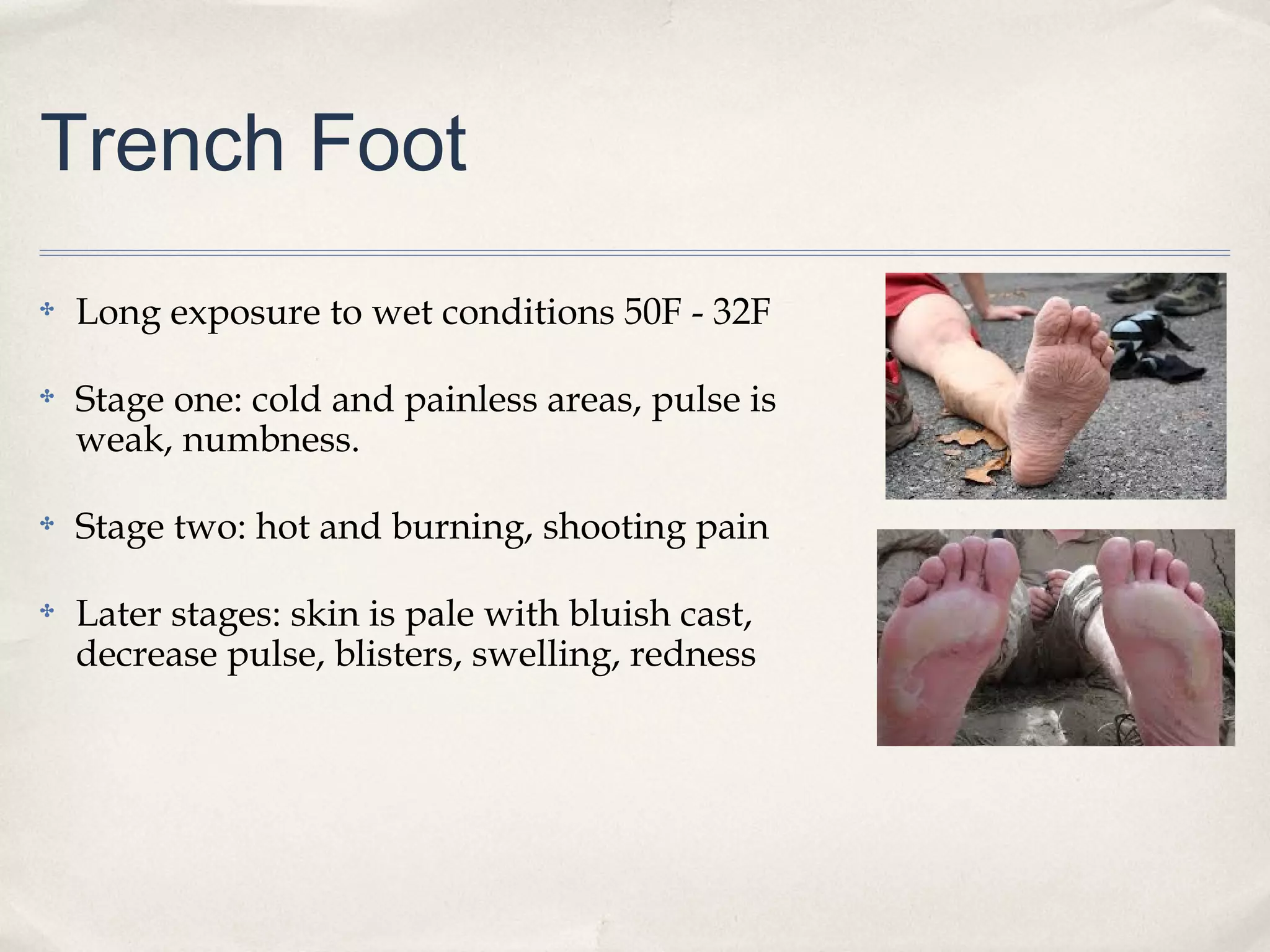 Cold Weather Injuries (Military) | PPT