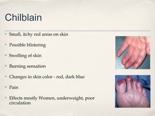 Cold Weather Injuries (Military) | PPT