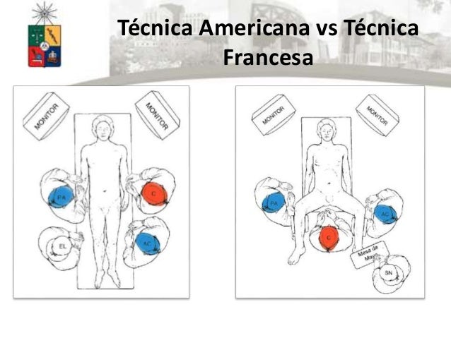 Colecistectomía abierta y vlp