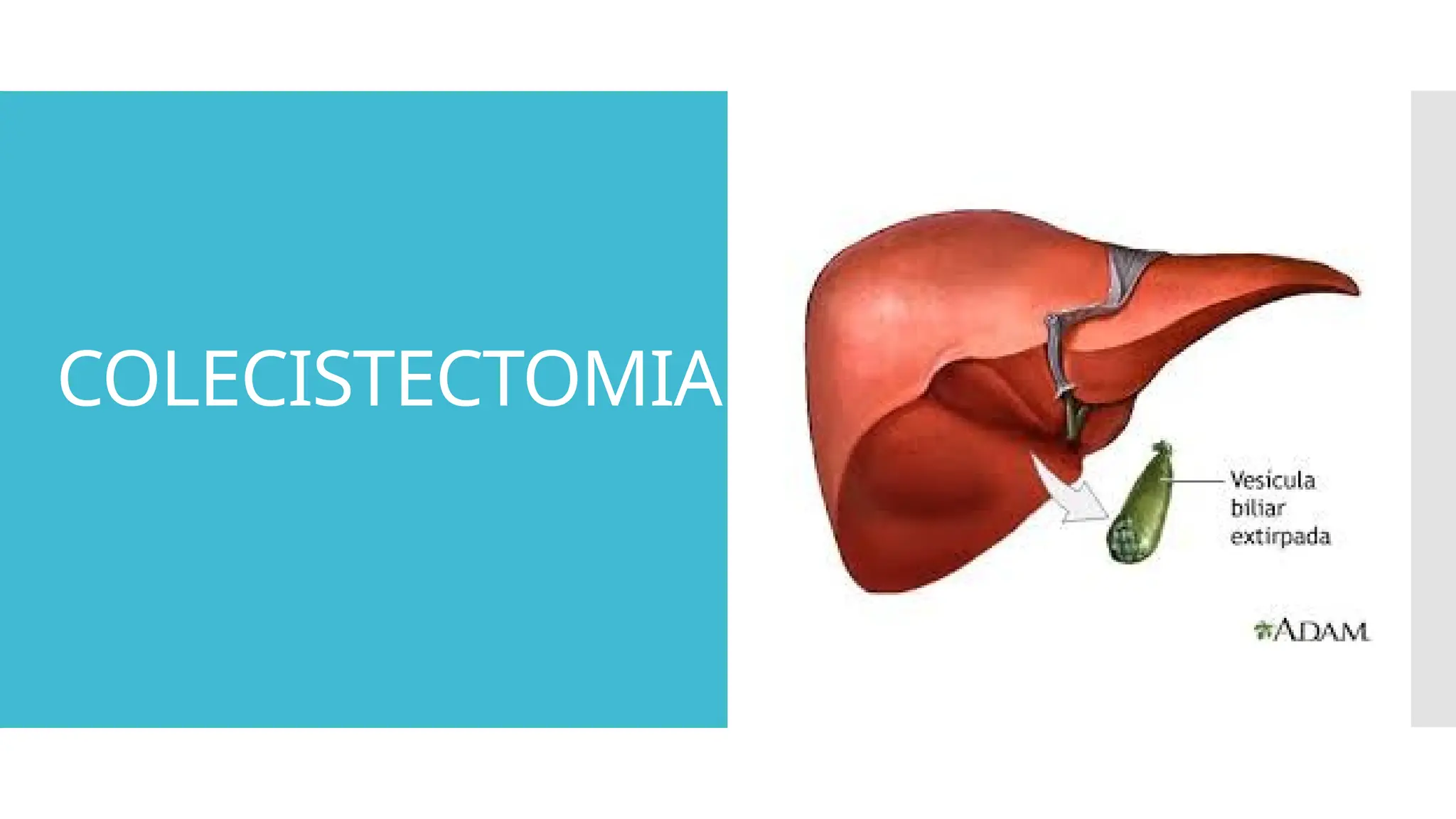 COLECISTECTOMIA ABIERTA ABDOMINAL, describe paso a paso con la ...