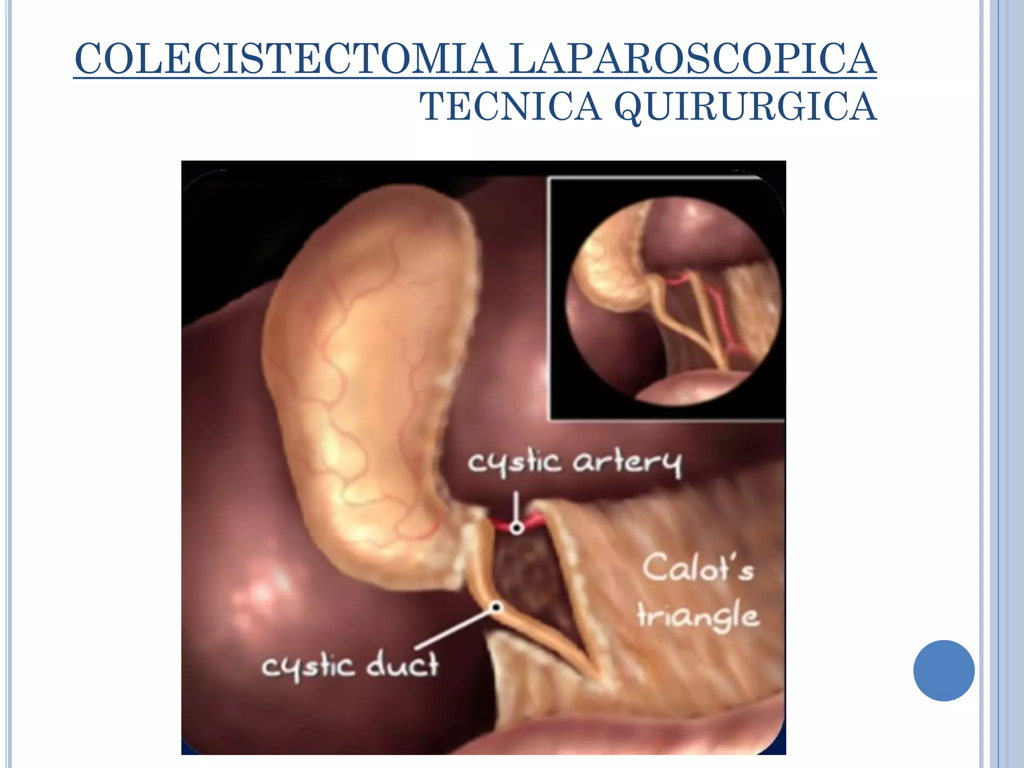 Colecistectomia laparoscopica | PDF | Physical Therapy | Wellness