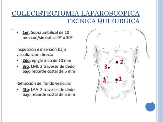 Colecistectomia laparoscopica | PDF | Physical Therapy | Wellness