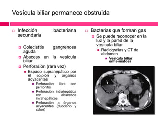 Colecistitis | PPTX